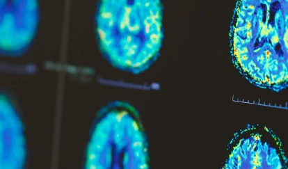 Causes and Effects of a Coup-Contrecoup Injury